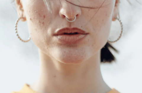 How to Treat a Skin Boil: Identification, Prevention & When You Should ...