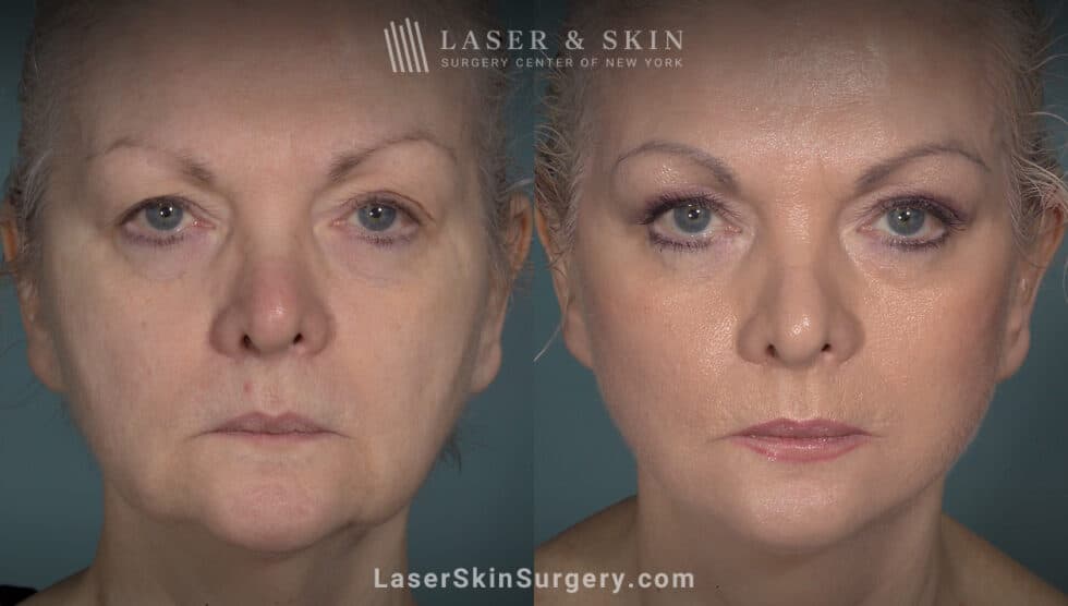 Cosmetic & Plastic Surgery - Laser NY