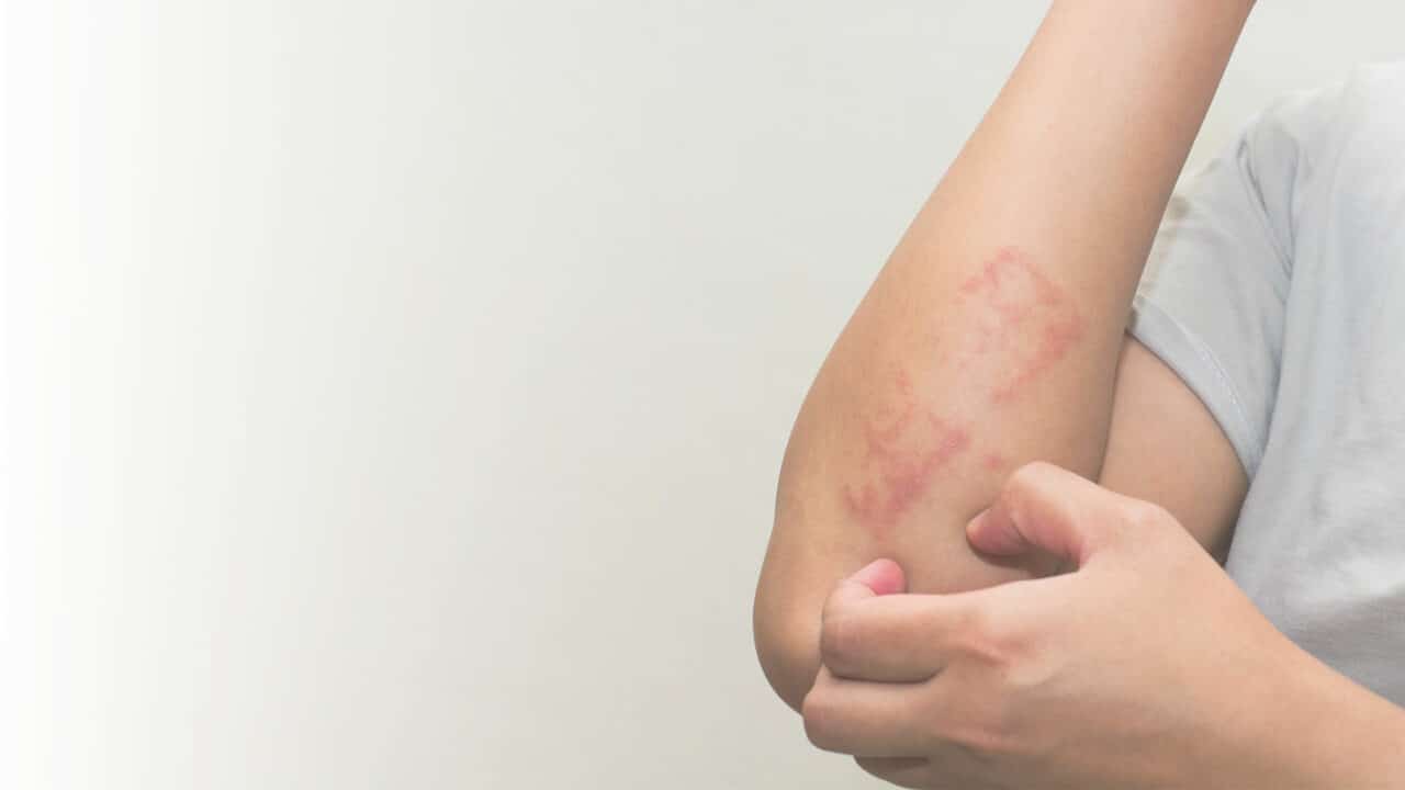 Pediatric Dermatology Overview New York, NY | Laser Center