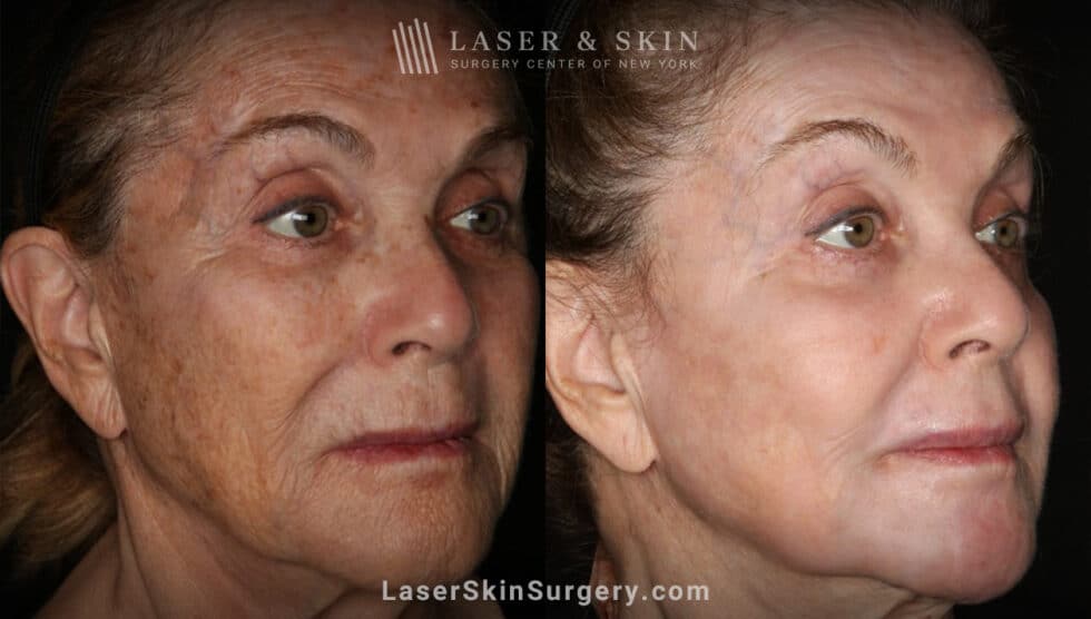 Laser & Skin Surgery Center of New York