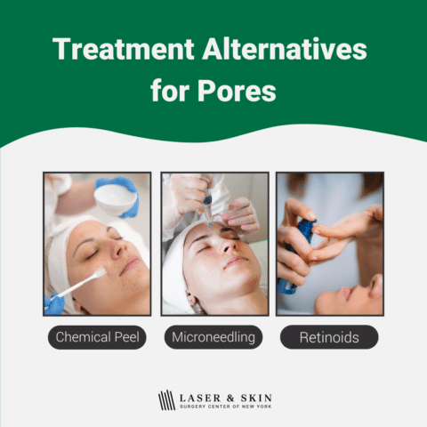 The Ultimate Guide to Laser Treatment for Shrinking Pores - Laser NY